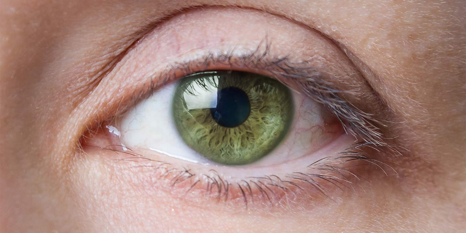 ¿Puede la medicina alternativa ayudar en el tratamiento del glaucoma ...